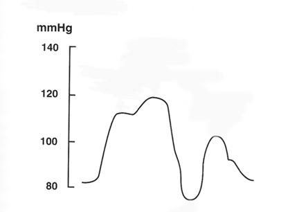 Question 3.2-2009, Paper 2 | Deranged Physiology