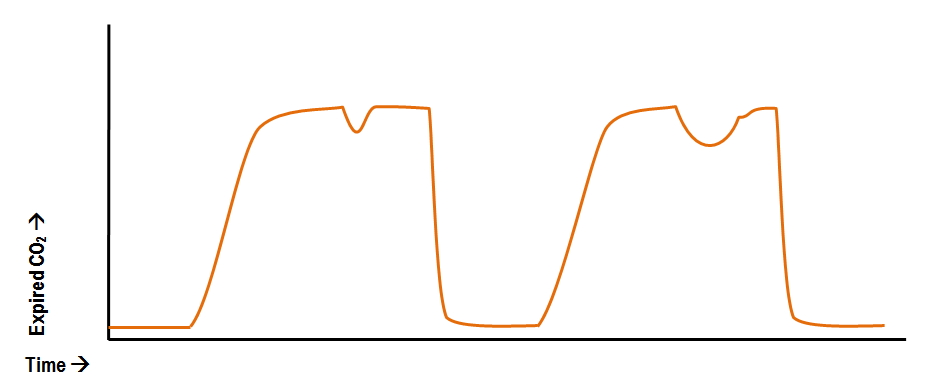 End-tidal capnometry waveform interpretation | Deranged Physiology